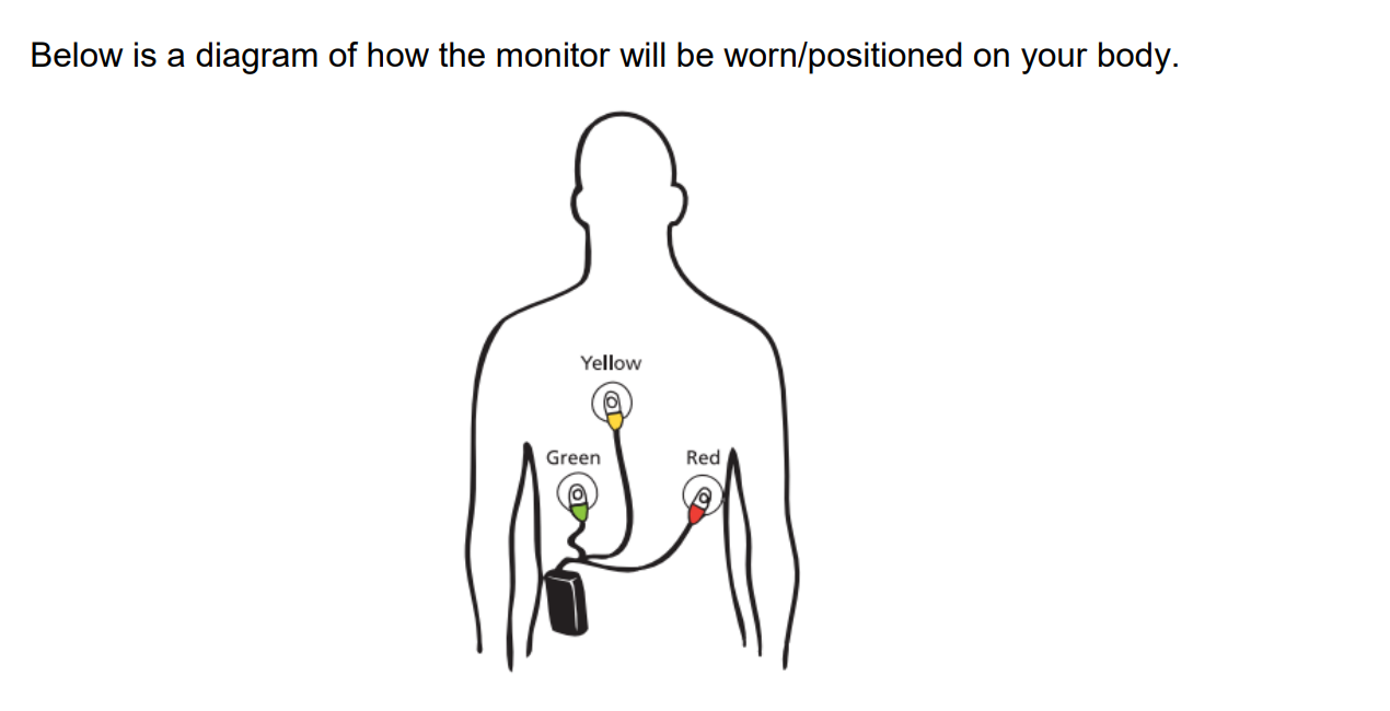 Seven-day Electrocardiogram (ECG) Patient information leaflet - The ...