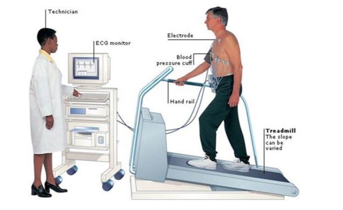 Exercise treadmill test (take medication) Patient information leaflet ...
